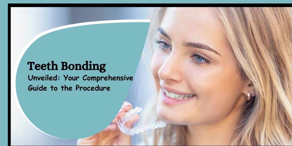 Teeth Bonding Unveiled: Your Comprehensive Guide To The Procedure
