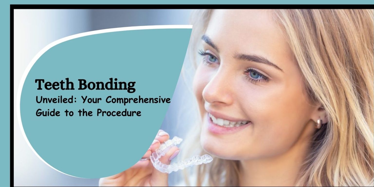 Teeth Bonding Unveiled: Your Comprehensive Guide To The Procedure